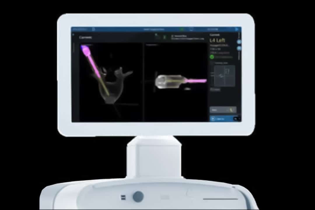 Robotic Spine Surgery – IBS Hospital